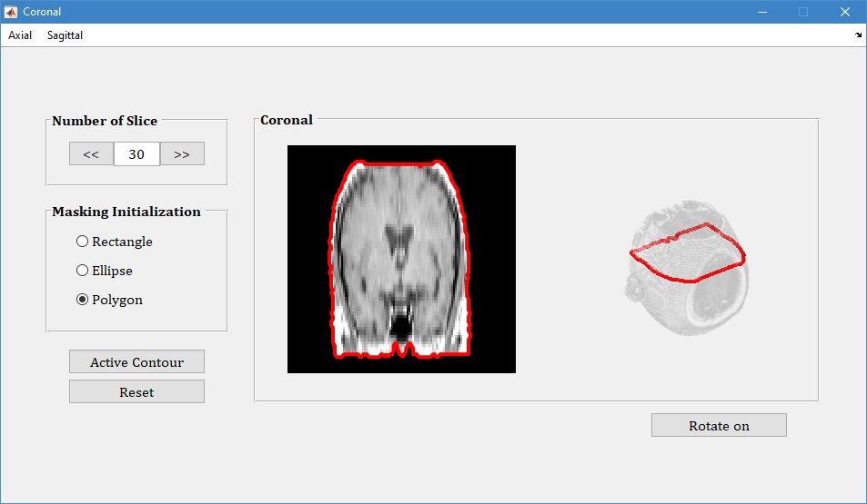 Segmentasi citra MRI dengan metode Active Contour | Pemrograman Matlab