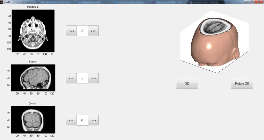 citra MRI Matlab | Pemrograman Matlab