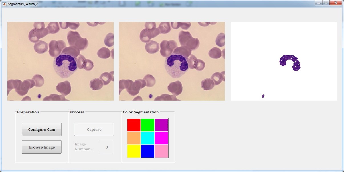 Metode Segmentasi Citra Digital | Pemrograman Matlab
