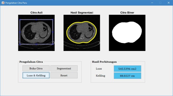 Pengolahan Citra CT Scan Paru-Paru dengan Metode Segmentasi Active ...