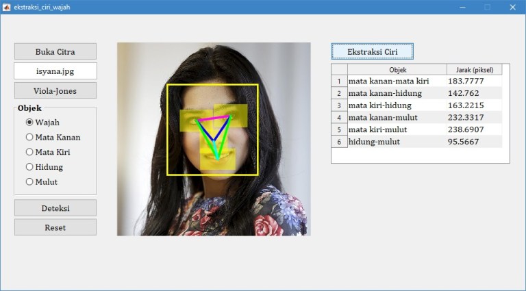 Metode Segmentasi Citra Digital | Pemrograman Matlab