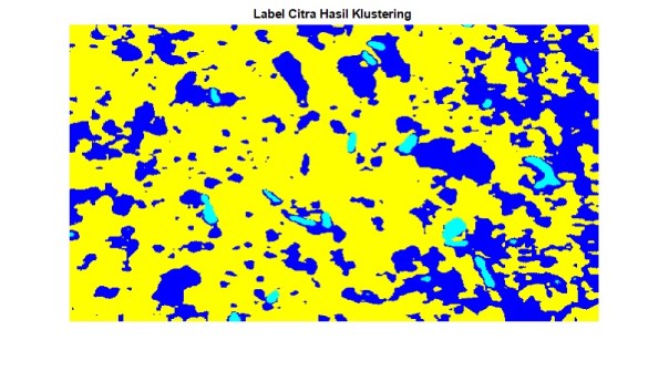 Segmentasi Citra Bakteri Tuberkulosis Menggunakan K-Means Clustering | Pemrograman Matlab