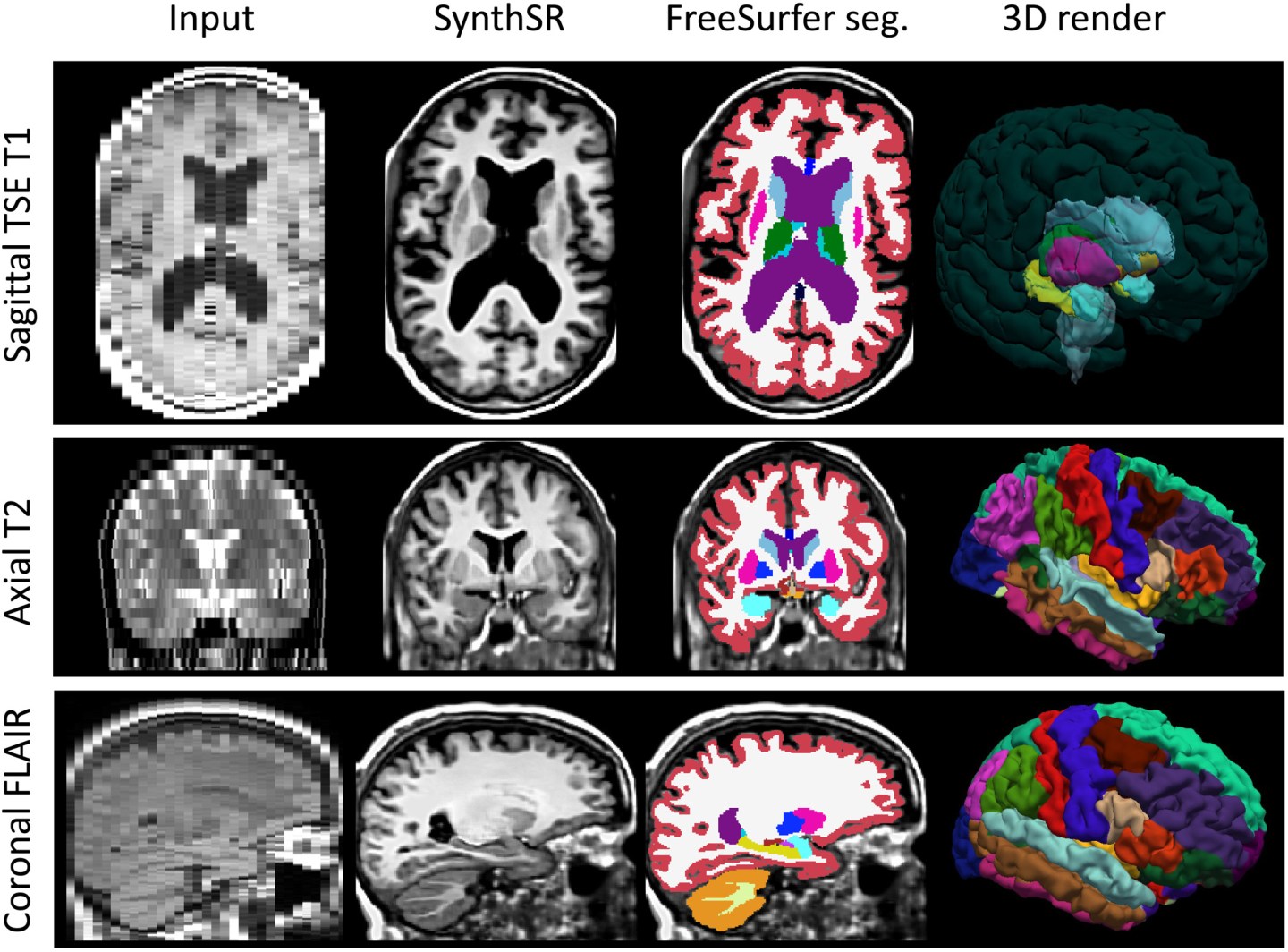 Visualisasi 3D Citra Kepala MRI: Tampang Axial, Sagital, dan Coronal ...
