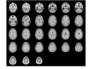 Pemrograman MATLAB untuk Pengolahan Citra Medis: Visualisasi 3D Citra ...