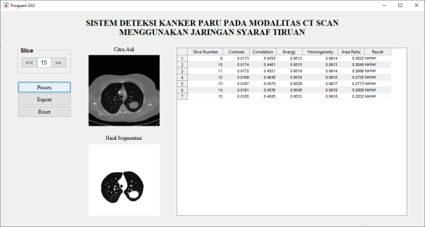 Deteksi Kanker Paru Menggunakan Jaringan Syaraf Tiruan pada Citra CT ...