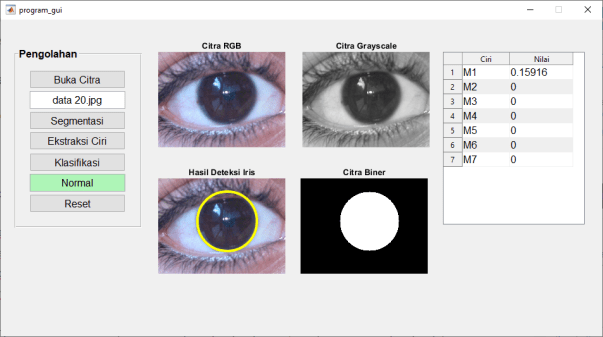 Penerapan Kecerdasan Buatan Berdasarkan Citra Iris Mata: Studi Kasus ...